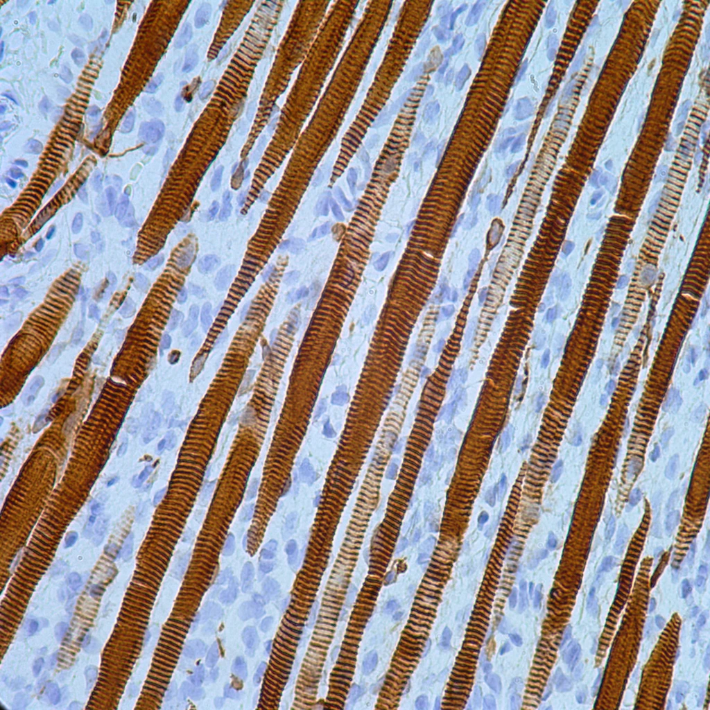Image - Desmin.skeletal muscle striations.400x.jpg - Pathology Resident ...