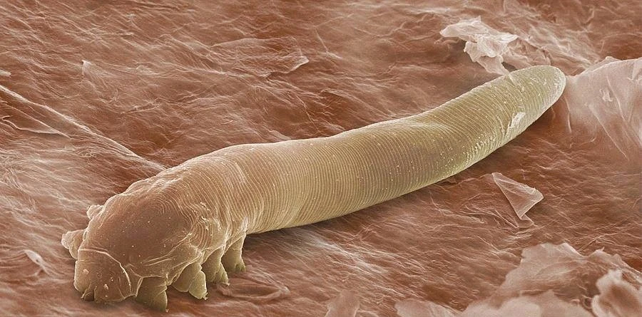 Demodex folliculorum - All Species Wiki - Wikia